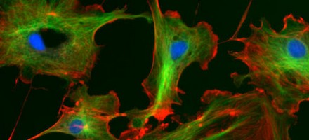 Des cellules malignes très malines